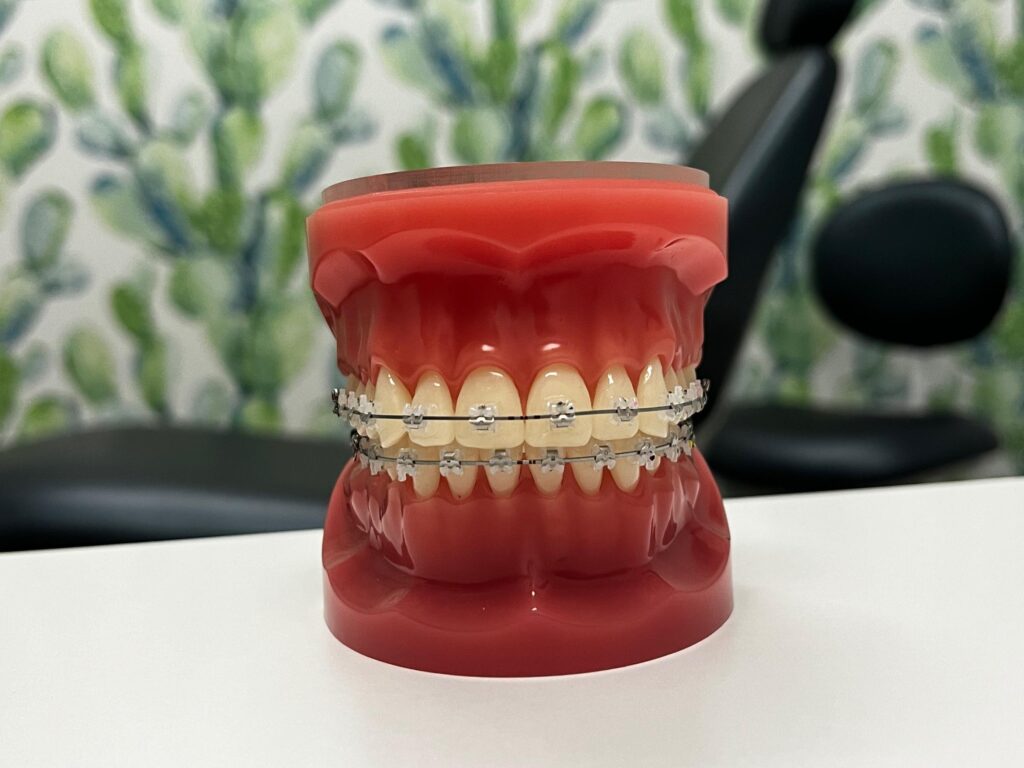 Clear Braces | Gross Orthodontics | Braces El Paso TX
